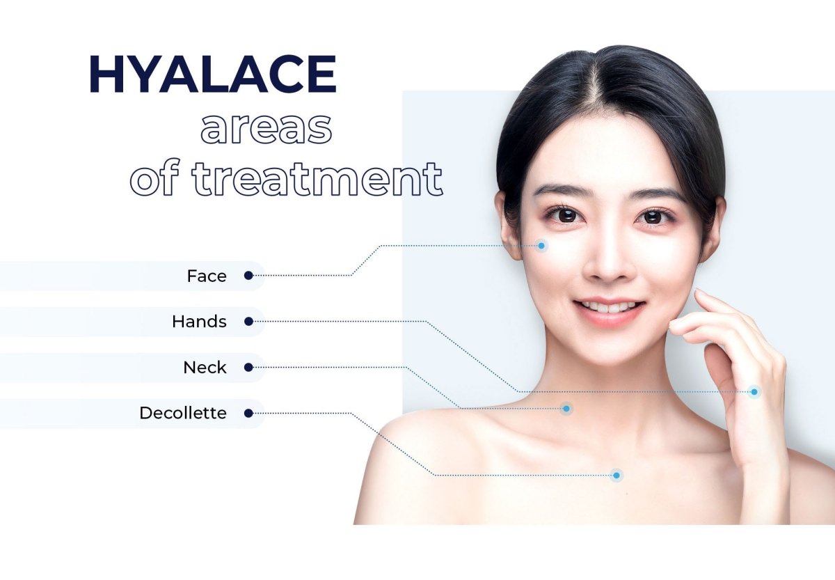 Hyalace Skin Booster – Smooth, Hydrate & Glow | Foxy Beauty